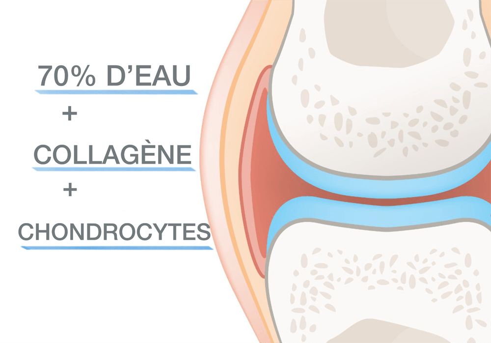 Comprendre la Différence entre Arthrite et Arthrose Facilement 👍