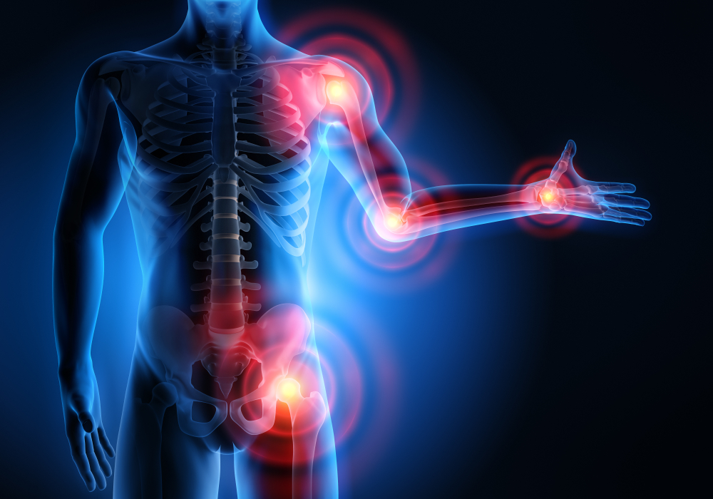 Le Secret Révélé sur les Réelles Causes de l'Arthrose 🔍